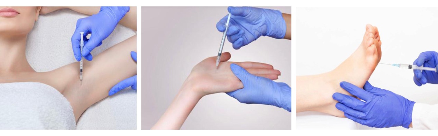 Hyperhidrosis & Treatments - Prof. Dr. Erkan Yıldırım